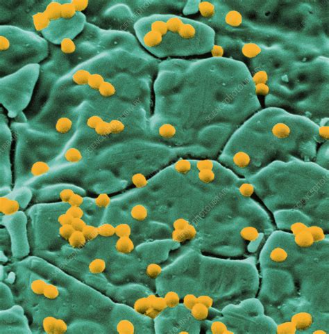 Staphylococcus Aureus Bacteria Stock Image B234 0075 Science
