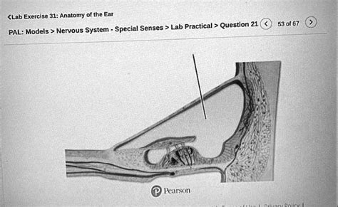 SOLVED Nervous System Special Senses Lab Practical Question 21