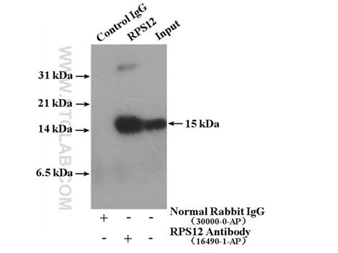 RPS12 Rabbit anti Human Mouse Rat Polyclonal Proteintech 150 μL