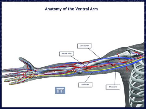 Anatomy Of The Ventral Arm TrialExhibits Inc
