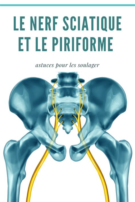 Le syndrome du piriforme c est quoi et comment l éviter Kinepilates