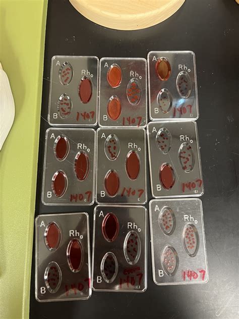 Blood Typing Diagram Quizlet