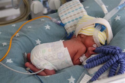 Día Mundial del Niño Prematuro Concientiza ISSSTE de Zacatecas sobre