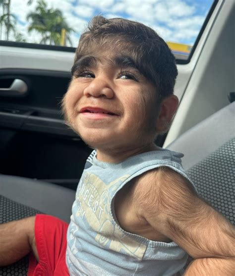 Bebê brasileiro que nasceu barba viraliza e se torna sensação na web