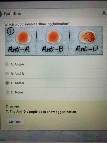 Lab Practical Flashcards Quizlet