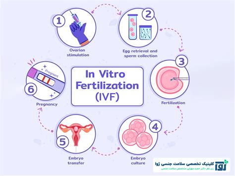 لقاح آزمایشگاهی یا IVF چیست و مراحل آی وی اف دکتر حمید مهرابی