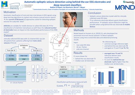 pdf automatic epileptic seizure detection using behind the ear eeg electrodes and deep