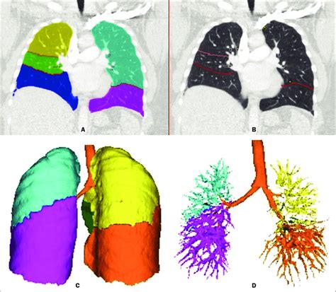 Illustrative Reconstructions Of The Automated Pulmonary Segmentation