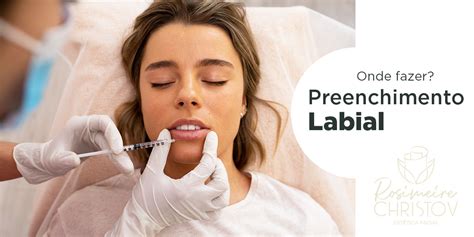 Preenchimento labial Principais Dúvidas sobre como é feito