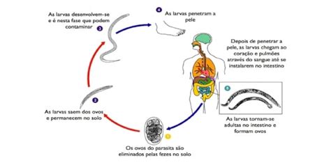 Questões sobre Nematelmintos RESPOSTAS e RESUMO