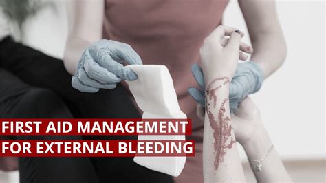 First Aid Management For External Bleeding FirstAid Lifesaver YouTube