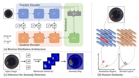 【论文笔记】cvpr2022：anomaly detection via reverse distillation from one class embedding revisiting