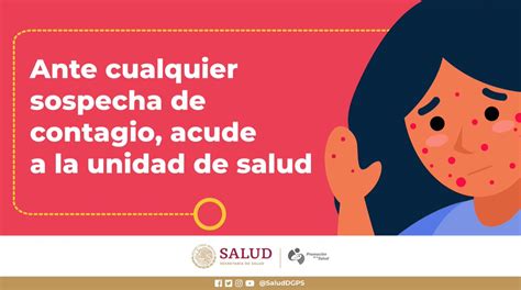 SSalud Tabasco On Twitter RT SaludDGPS Si Has Tenido Contacto Con