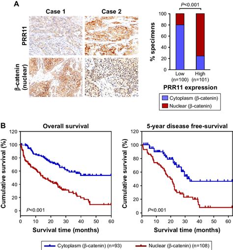 clinical relevance of Prr11 induced Wnt β catenin activation in escc