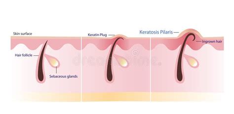 Diagram Of Hair Follicle Shape Vector Illustration Isolated On White