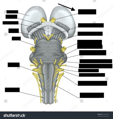 Neuro Practical Brainstem Final Flashcards Quizlet