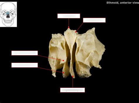 Ethmoid Bone Diagram Quizlet