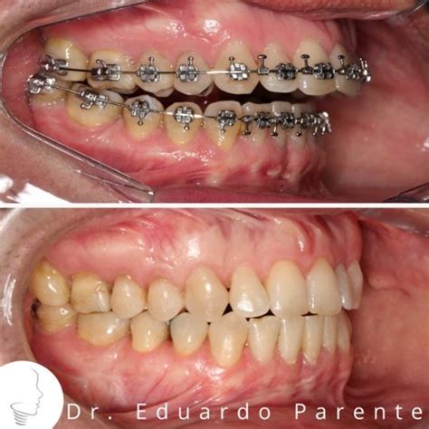 Cirurgia Ortogn Tica Dr Eduardo Parente
