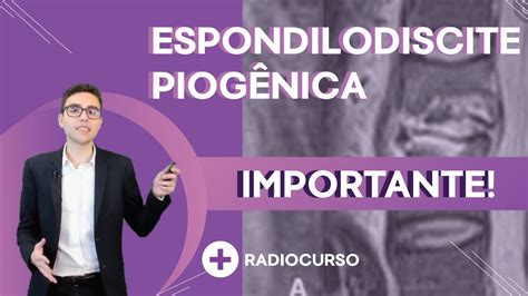 Coluna Espondilodiscite Piogênica YouTube