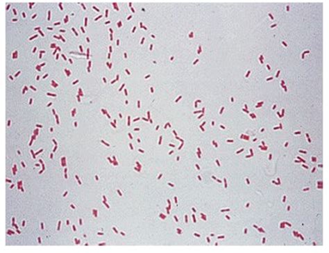 Gram Negative Rods Flashcards Quizlet