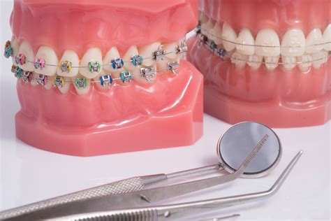 Clarity ADVANCED Ceramic Braces Hardy Pediatric Dentistry Orthodontics