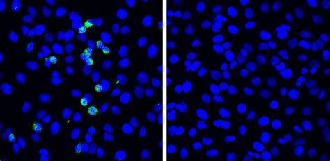 A Novel Defense Mechanism For SARS CoV 2 Discovered Hokkaido University
