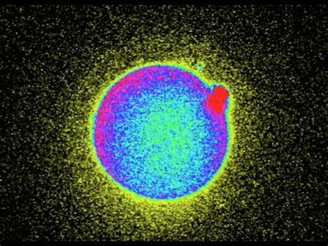 WATCH Brilliant Flash Of Light At Moment Of Conception Proves Life