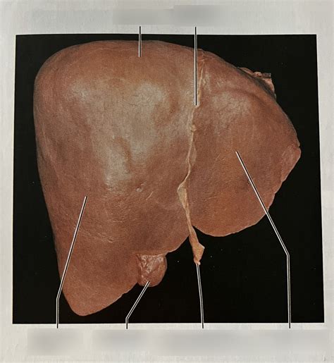 Anterior View Of Liver Diagram Quizlet