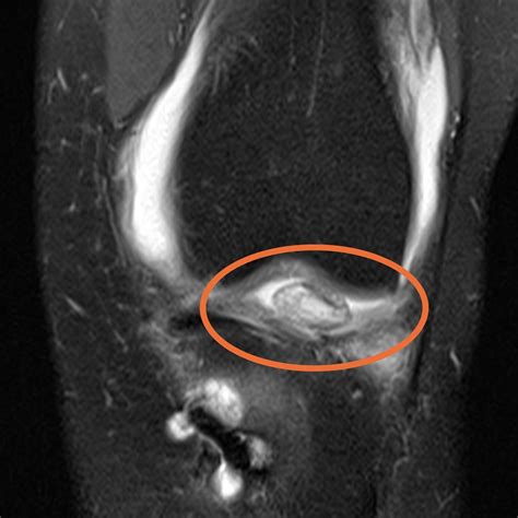 Zyklopssyndrom Orthopäde Wien