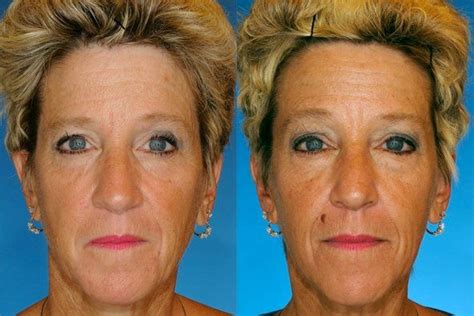 The Well Smoking Quiz Who Looks Older Look Older Face Wrinkles