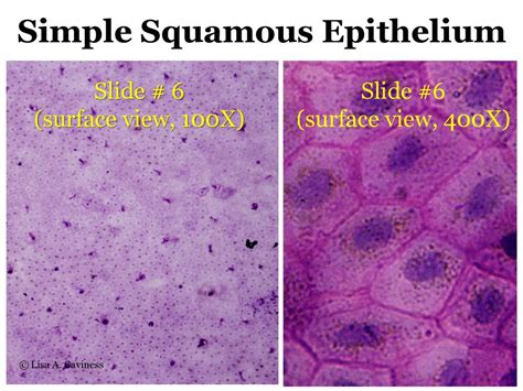 Stratified Squamous Epithelium Keratinized 400x