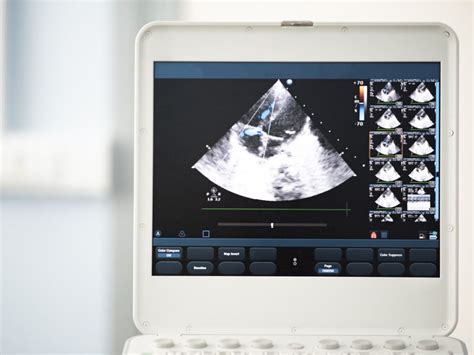 USG Doppler Badanie Dopplera Jak przebiega Jak się przygotować