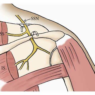 The Drawing Of The Medial Aspect Of The Ankle Showing The Course Of The