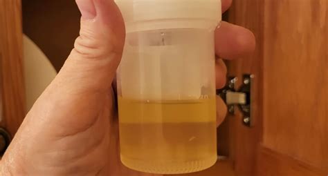 8 Ways To Keep Pee Warm For Drugs Test What Pill Bottle Temp Fails