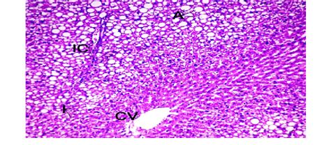 A Photomicrograph Of A Liver Section From F Rats Showing Both