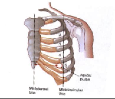 Cardiovascular Ppt Flashcards Quizlet