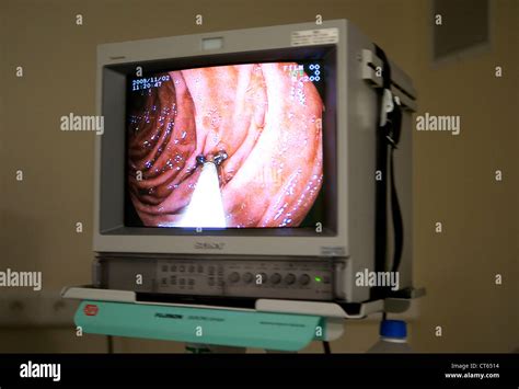 Biopsien Fotos und Bildmaterial in hoher Auflösung Alamy