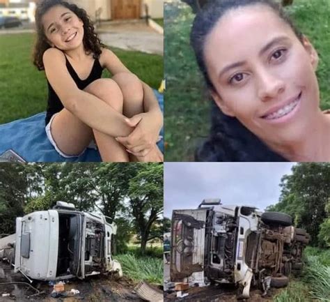 Criança que teve o corpo atingido por piche e ficou 70 do corpo