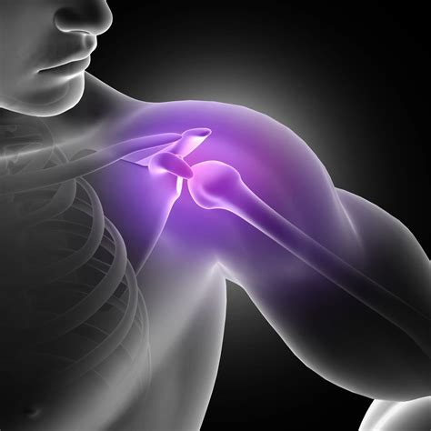 Torn Rotator Cuff Non Surgical Recovery MVM Health