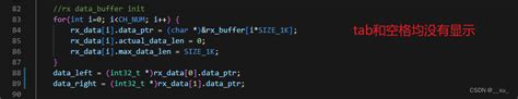 【工具使用 vscode】vscode如何设置空格和tab键显示 vscode显示空格 csdn博客