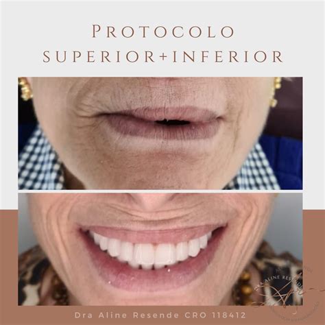 Próteses Dentárias Clínica A R