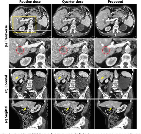 figure 1 from a deep convolutional neural network using directional wavelets for low‐dose x‐ray