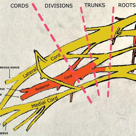 Brachial Plexus Formation Roots Trunks Divisions And Cords Of The