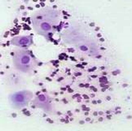 Fa K Vaginal Cytology Flashcards Quizlet