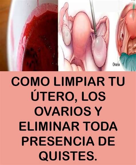 COMO LIMPIAR TU ÚTERO LOS OVARIOS Y ELIMINAR TODA PRESENCIA DE QUISTES