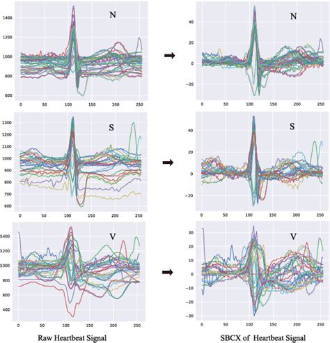 figure 7 from inter patient ecg classification with symbolic representations and multi
