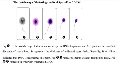 Economical Sperm DNA Fragmentation Test Kit For DNA Fragmentation Level