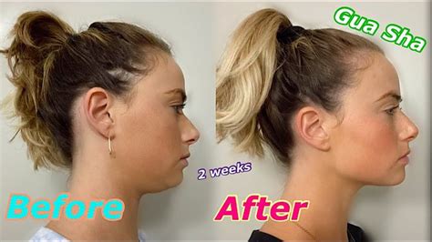 2 WEEK GUA SHA TRANSFORMATION SHOCKING RESULTS HOW I DID IT