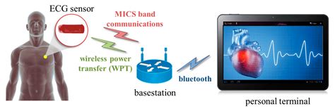 micromachines free full text development of ecg monitoring system and implantable device