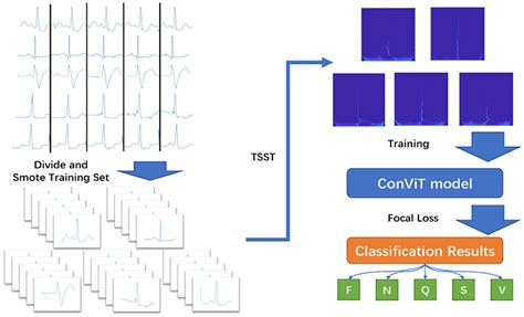 frontiers electrocardiogram classification using tsst based spectrogram and convit